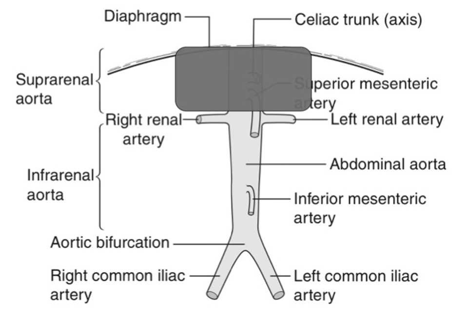 Management of non-visualised aortas - GOV.UK