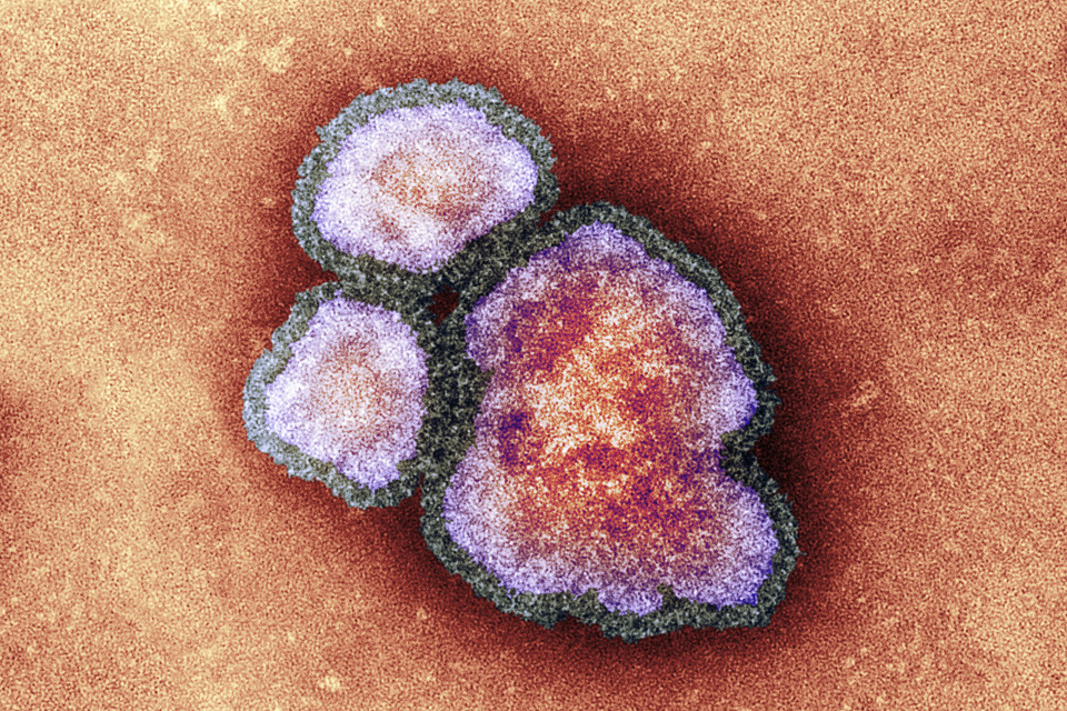 Measles at highest level for 18 years - GOV.UK Measles at highest level for 18 years - GOV.UK