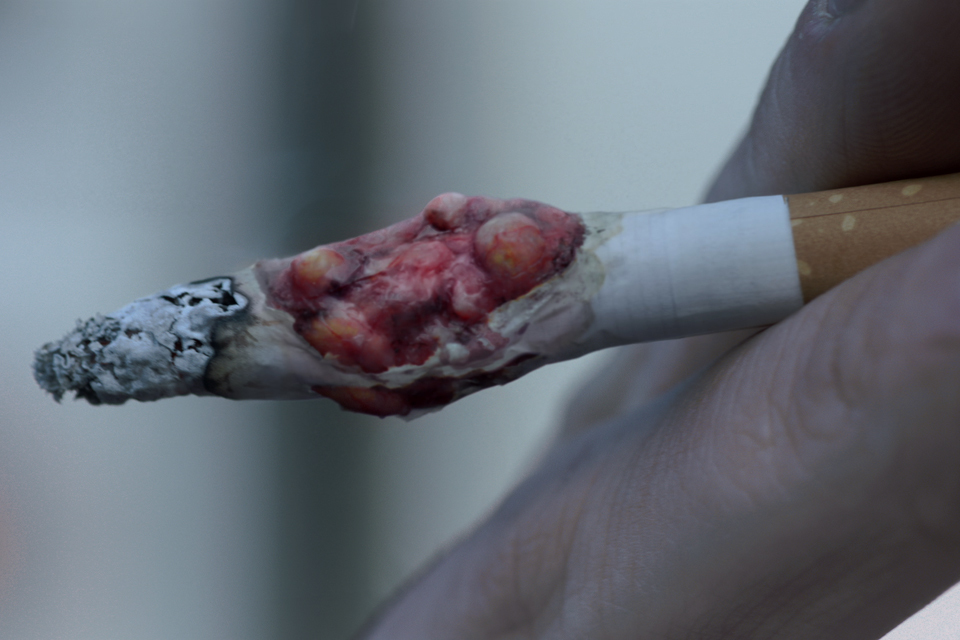 Chronic smoking-related lung disease blights over 1 million lives in ...